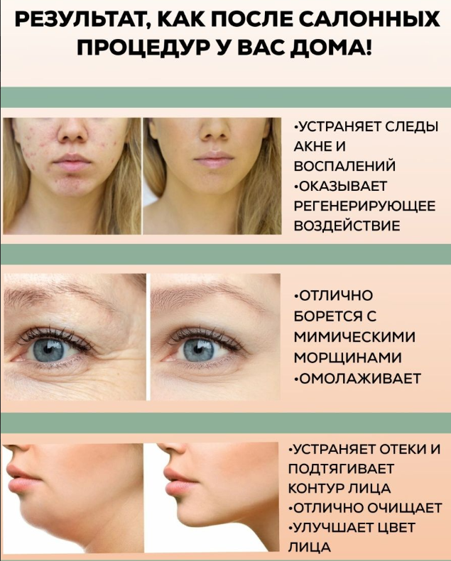 Микротоковый лифтинг-массажер для лица и шеи Intense Pulsed Light (IPL ...